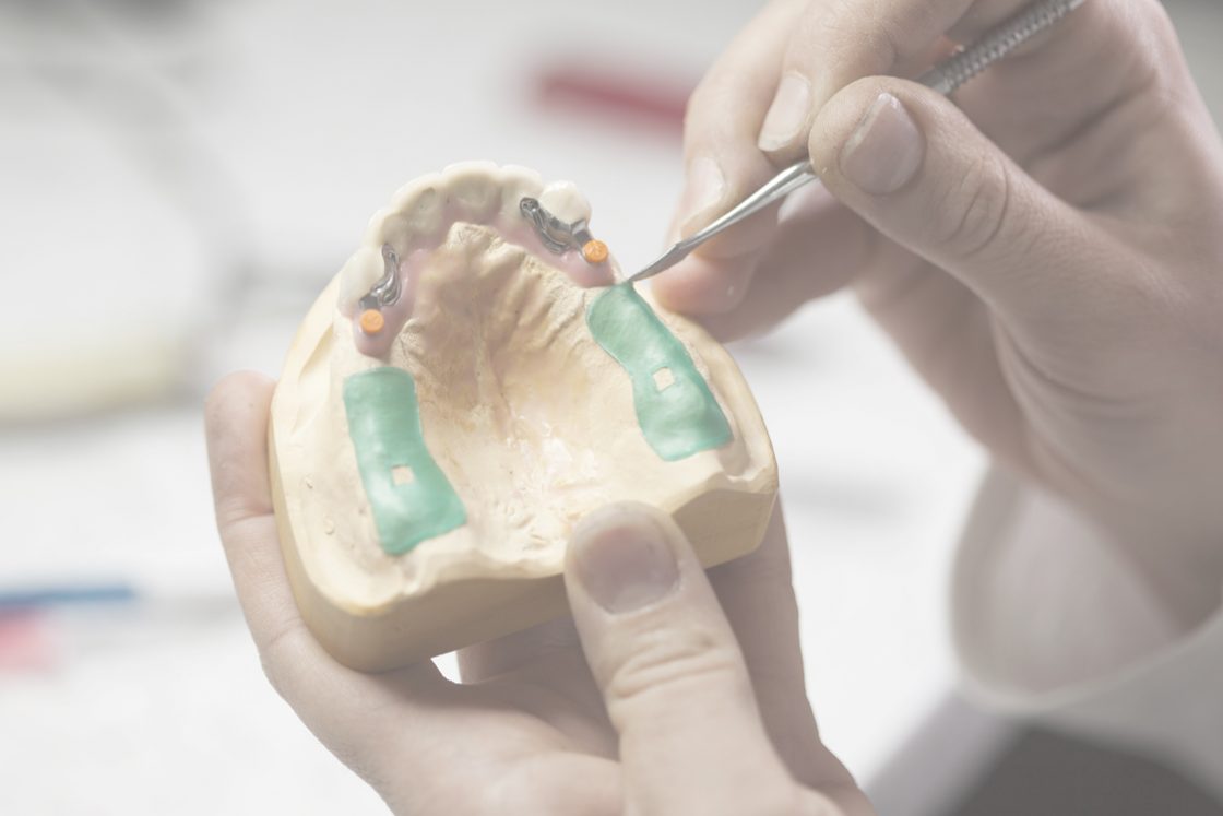 La base molle | Centres dentaires Lapointe